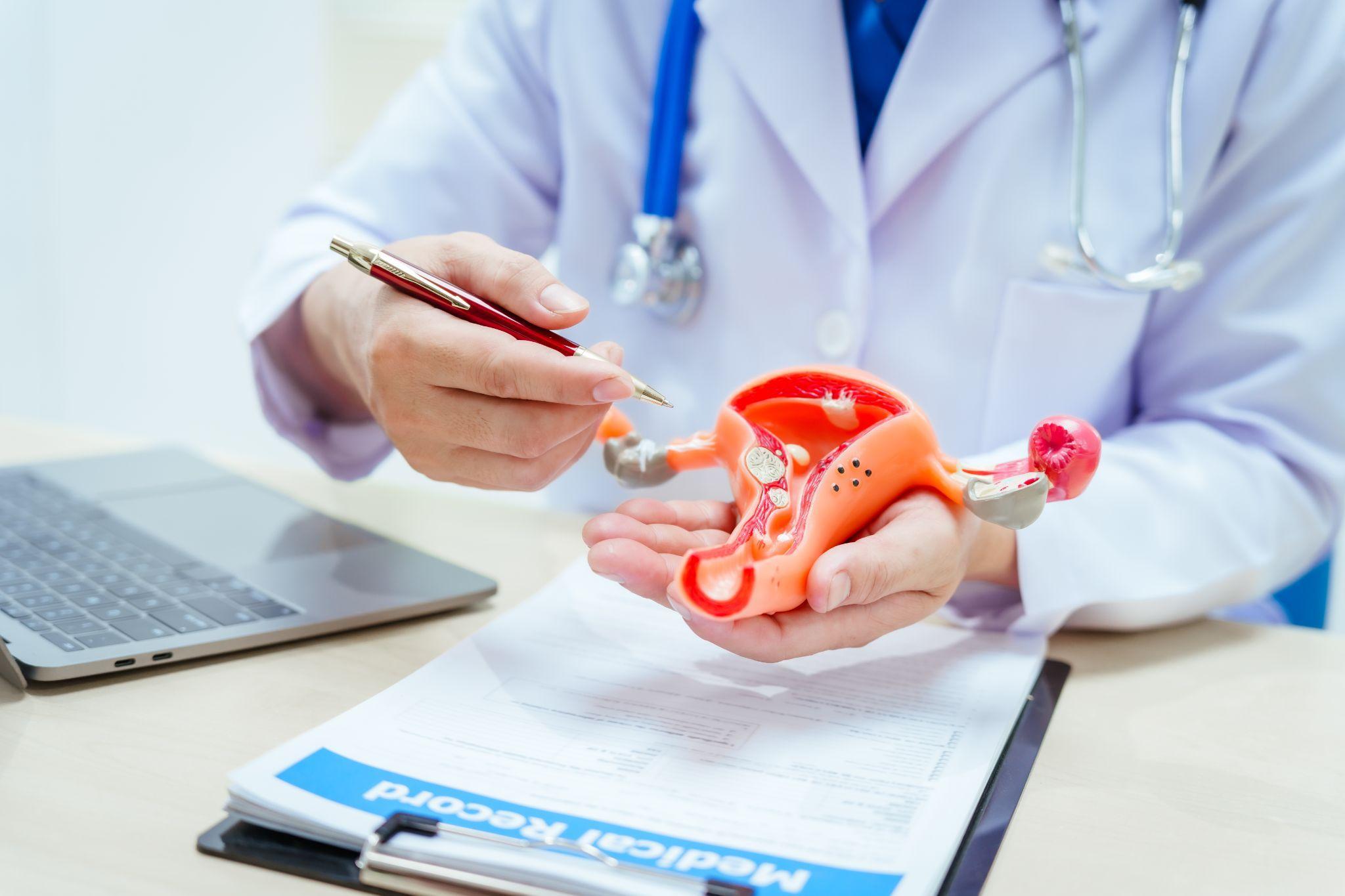 Endometriosis Treatment & Ablation in Murrieta & Beverly Hills